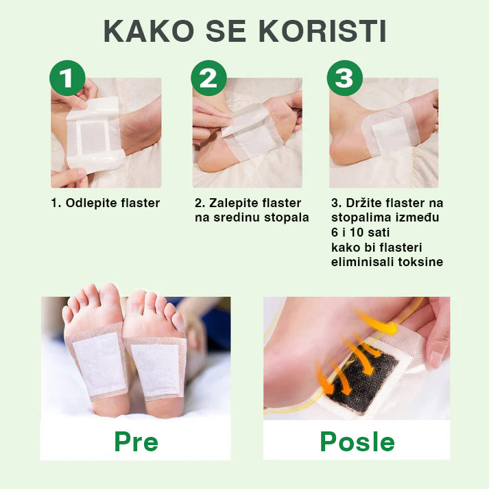 Сет од 20 фластери за детоксикација (10 дена детокс) – Solvio MK